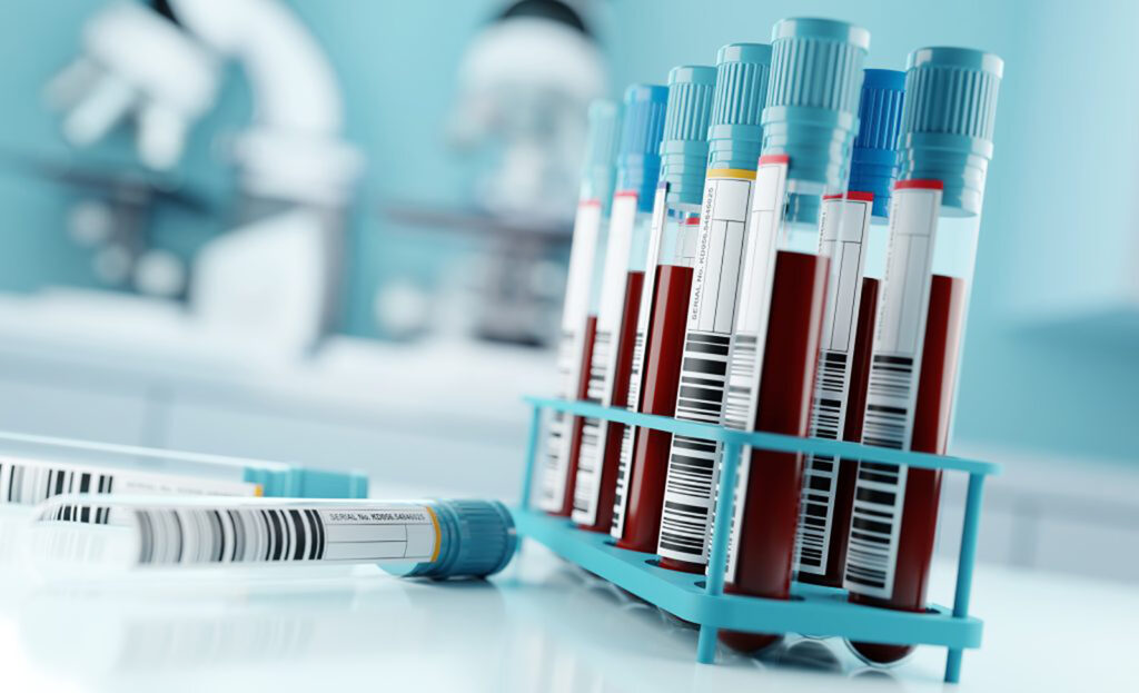 Atrogi Announces Positive Clinical Data from First-in-Class Insulin ...